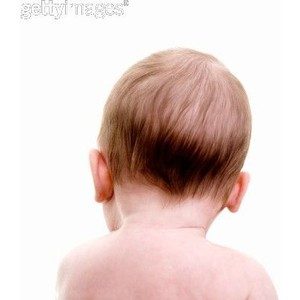 Plagiocephaly - How an Osteopath Can Help